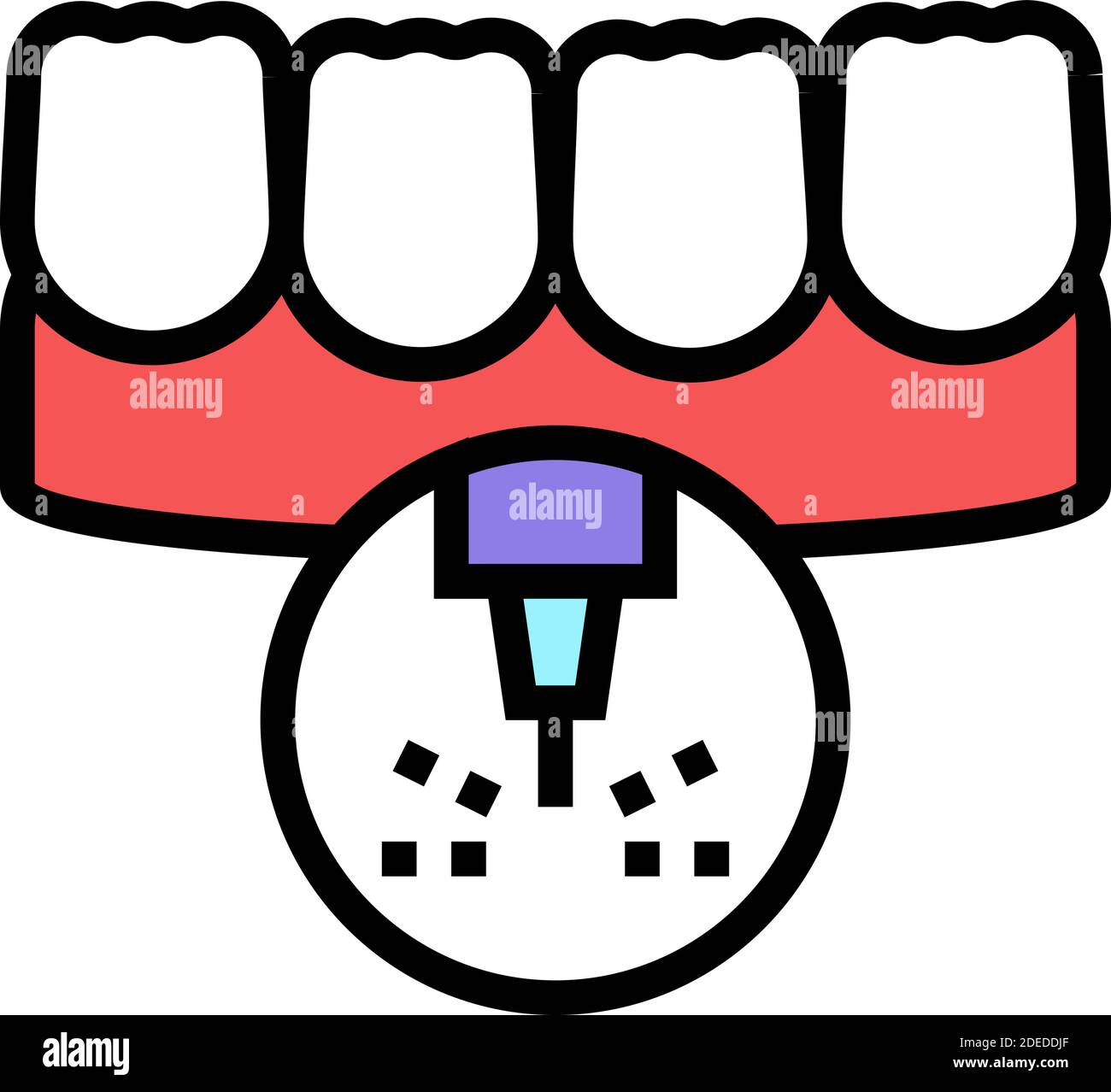 stomatology teeth laser treatment color icon vector illustration Stock ...