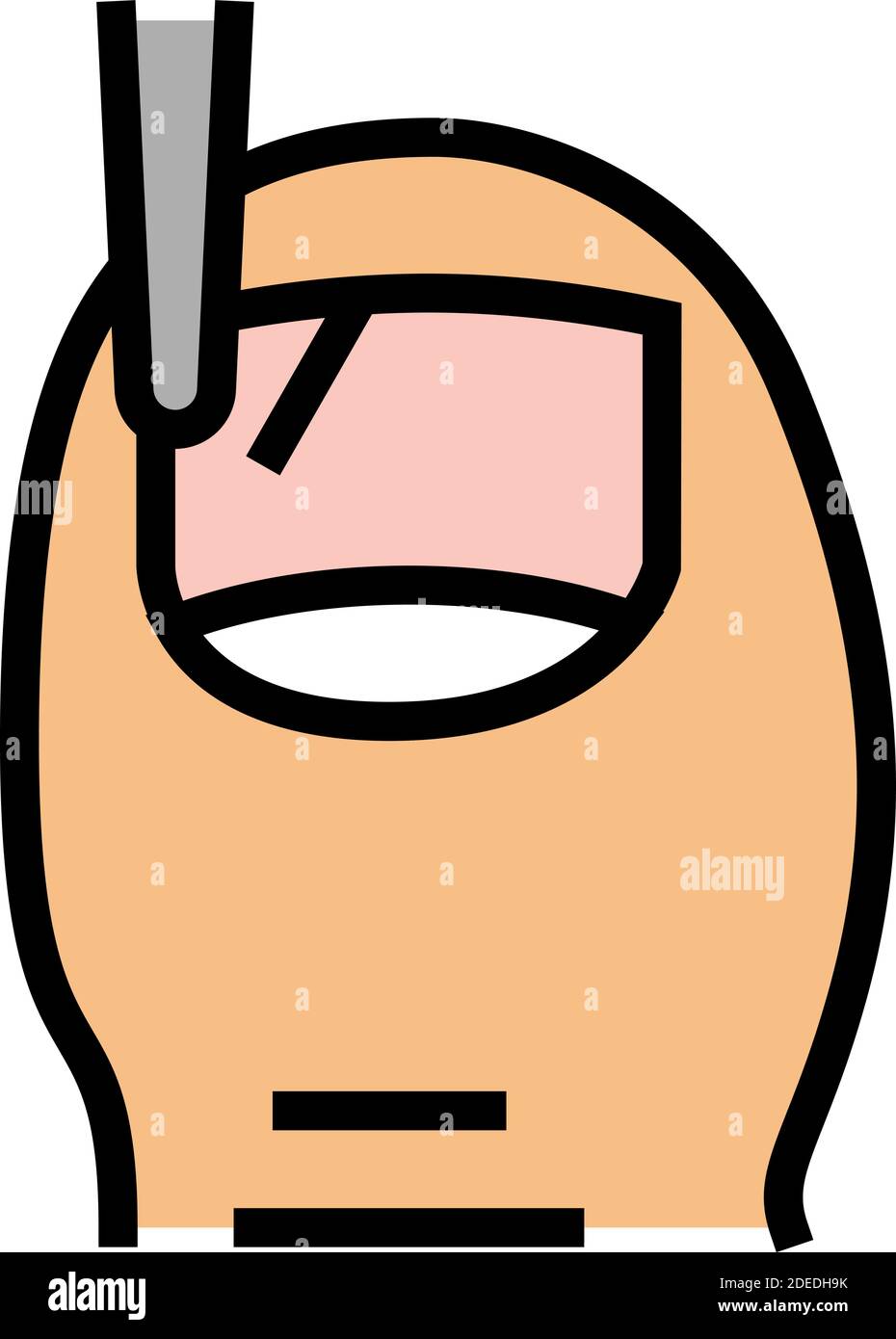 surgical intervention medical therapy color icon vector illustration ...