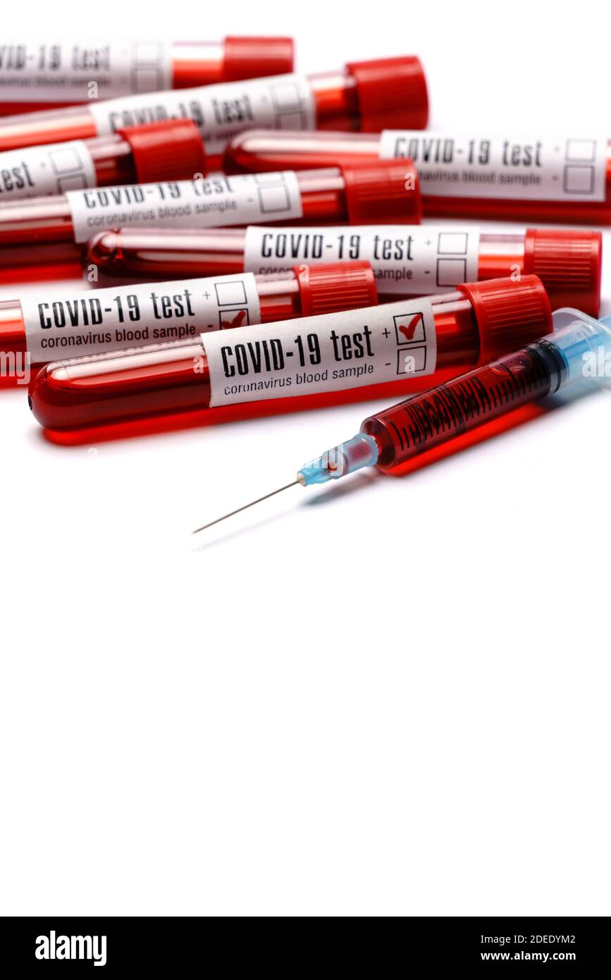 Blood test tube with red plug isolated on white background Stock Photo ...