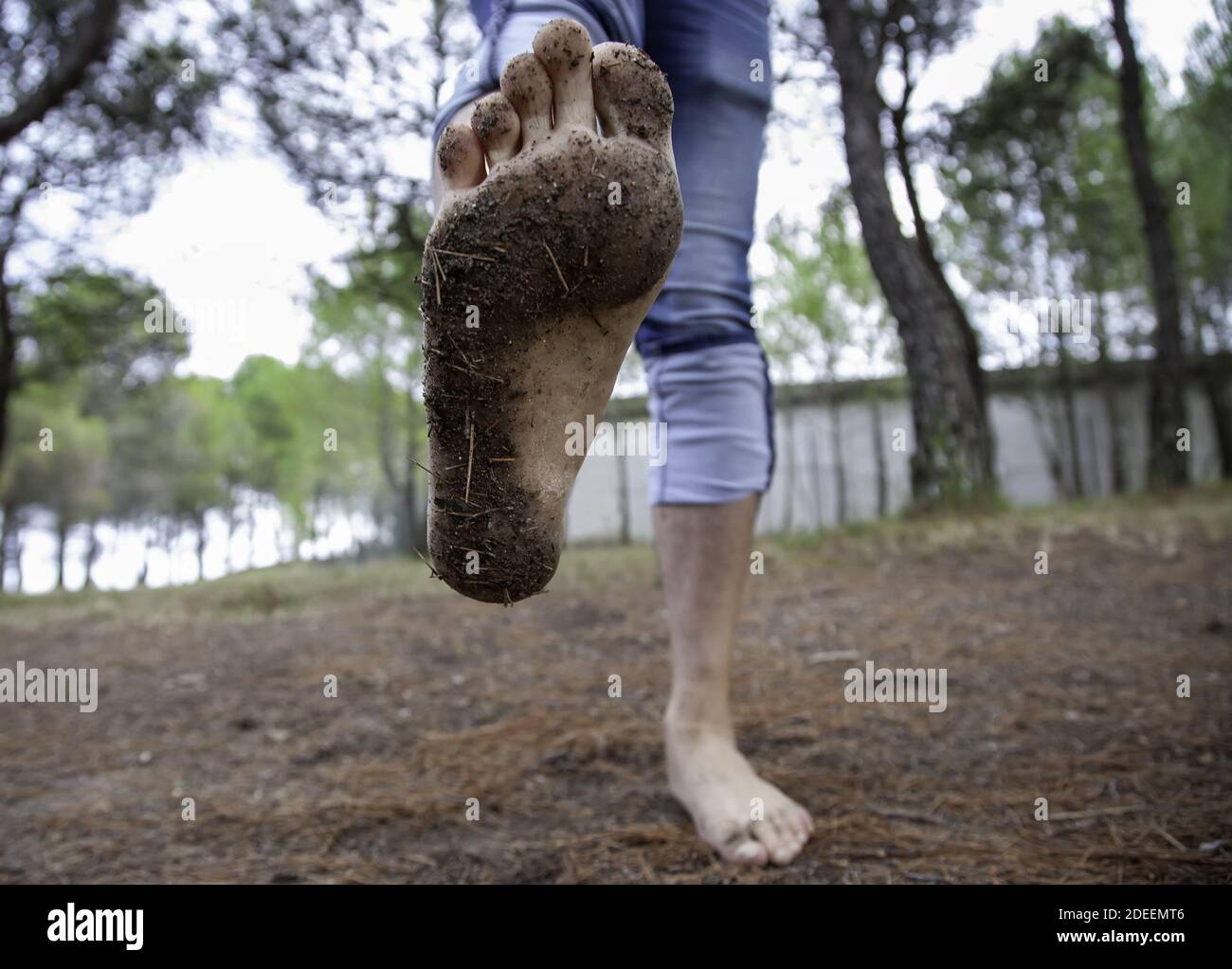 Dirty feet in forest, homeless and destitute person, infection Stock ...