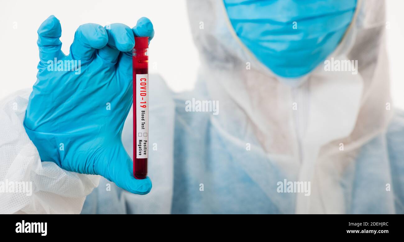 Medical scientist in PPE uniform wear a mask holding test tube ...