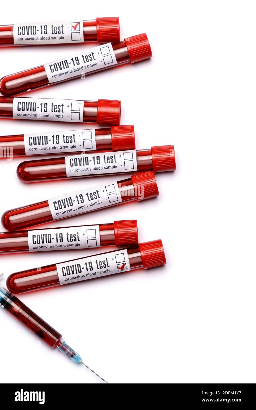 Blood test tube with red plug isolated on white background Stock Photo ...