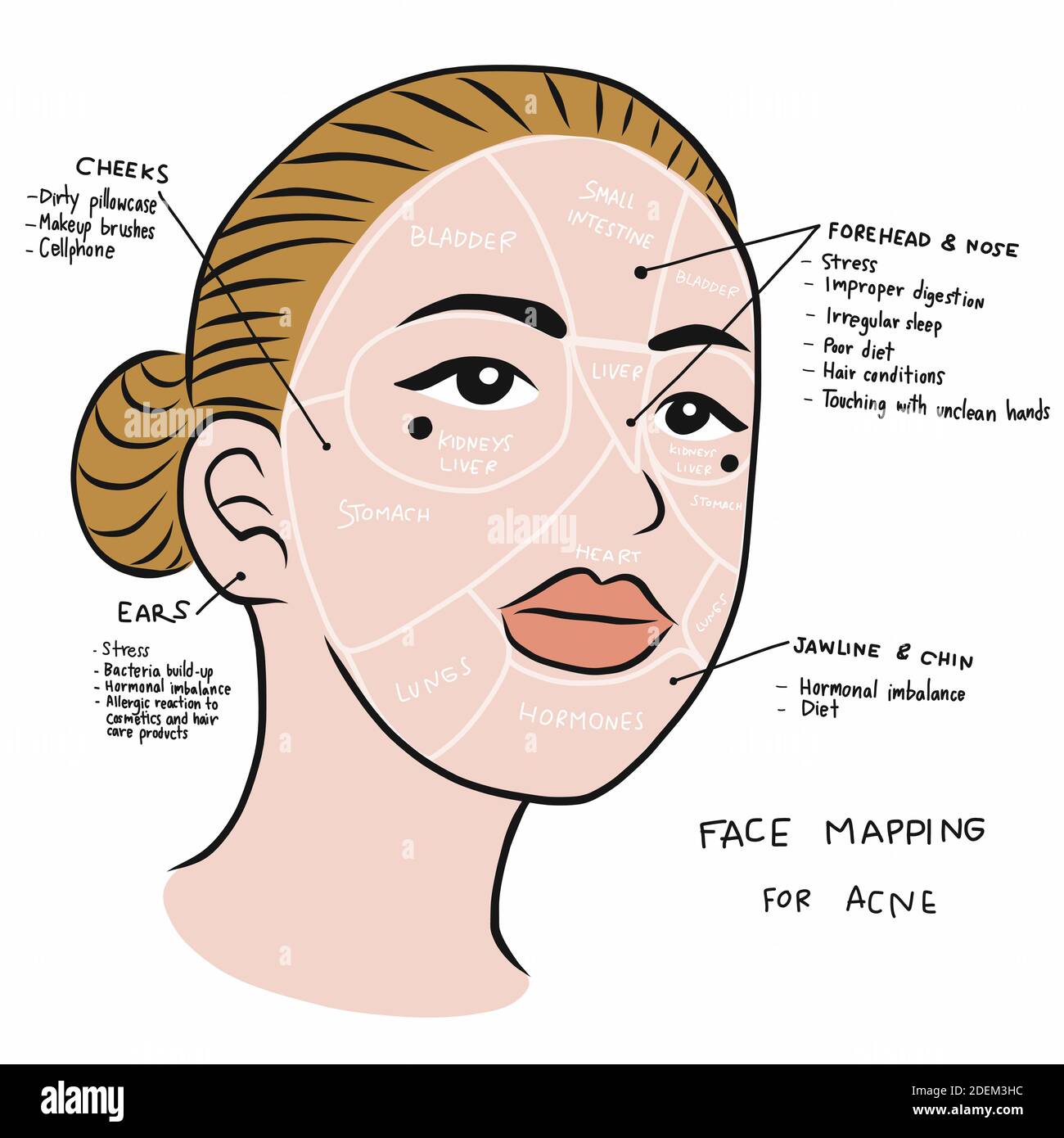 Face mapping for acne , beautiful woman face vector illustration Stock ... Face mapping for acne , beautiful woman face vector illustration Stock ...
