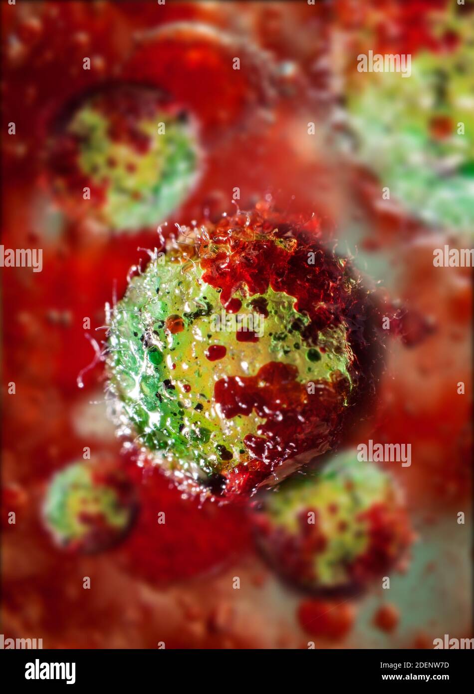 Bacterial meningitis meninges hi-res stock photography and images - Alamy