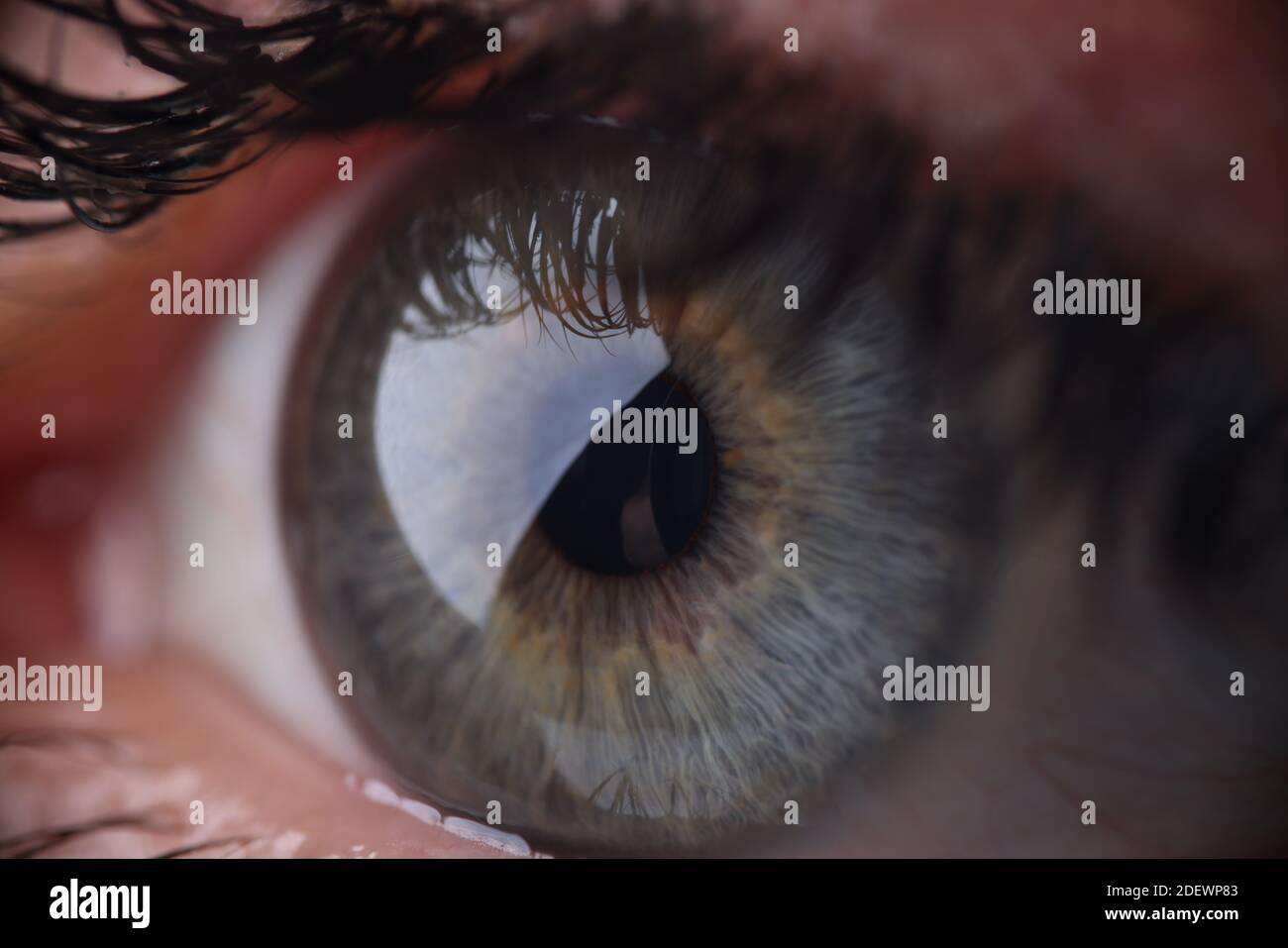 Healthy cornea hi-res stock photography and images - Alamy