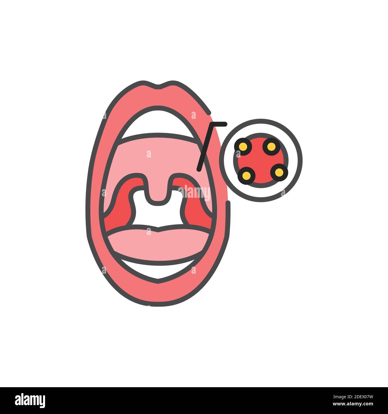 Tonsil drawing hi-res stock photography and images - Alamy