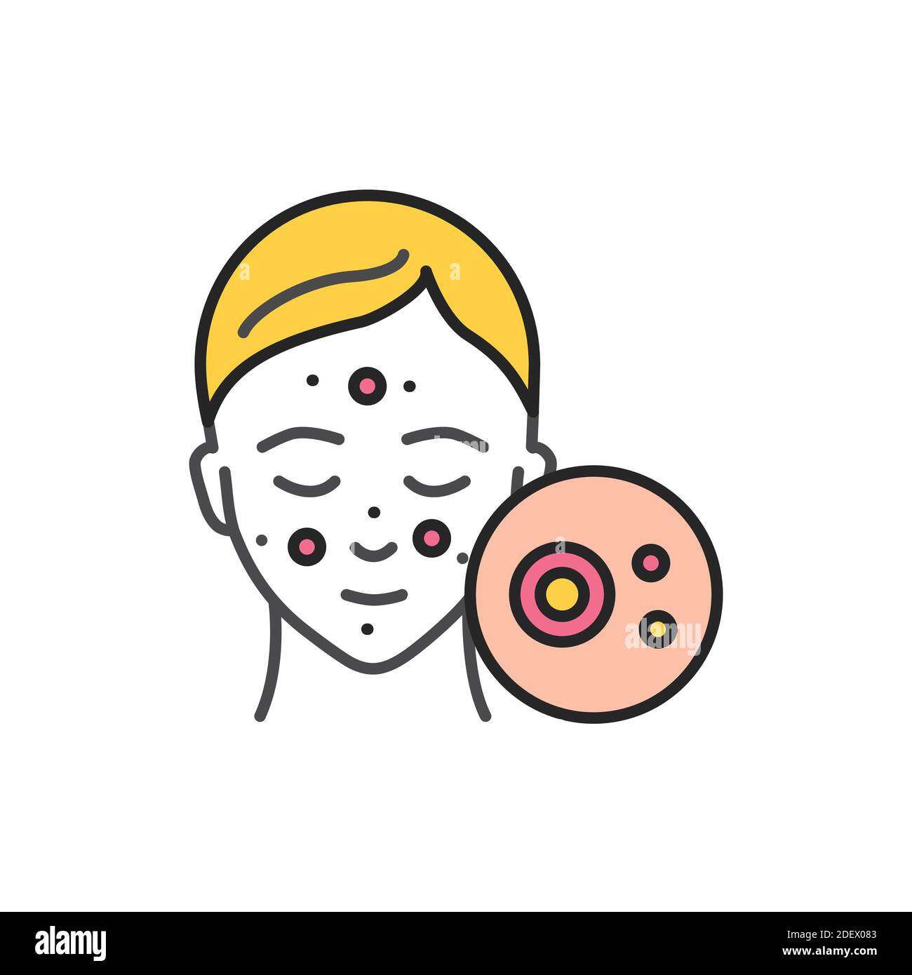 Acne skin line color icon. Sign for web page, mobile app Stock Vector ...