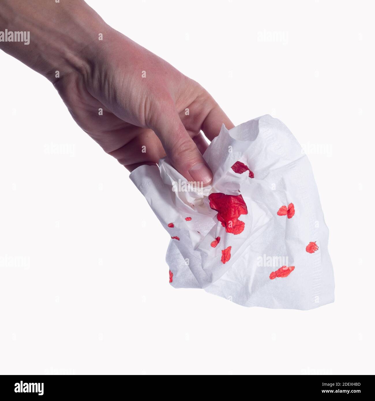 Accident arm bleeding blood bloody hi-res stock photography and images ...