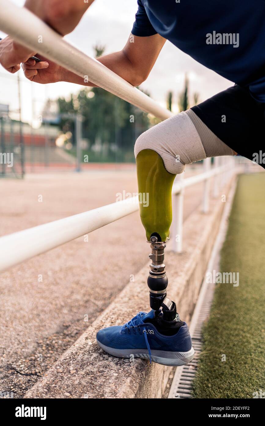 Close up disabled man athlete with leg prosthesis. Paralympic Sport ...