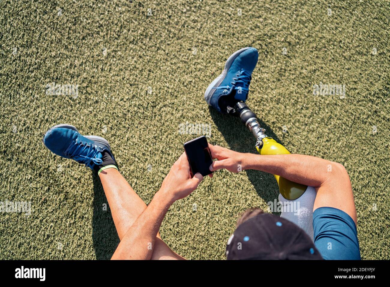 Young man prosthetic leg using hi-res stock photography and images - Alamy
