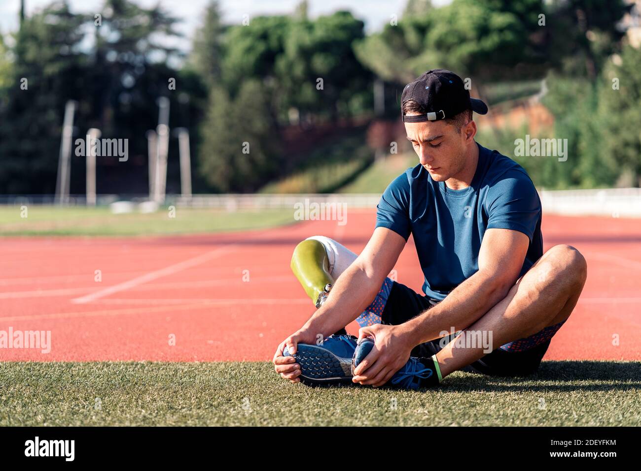 Disabled man athlete stretching with leg prosthesis. Paralympic Sport ...