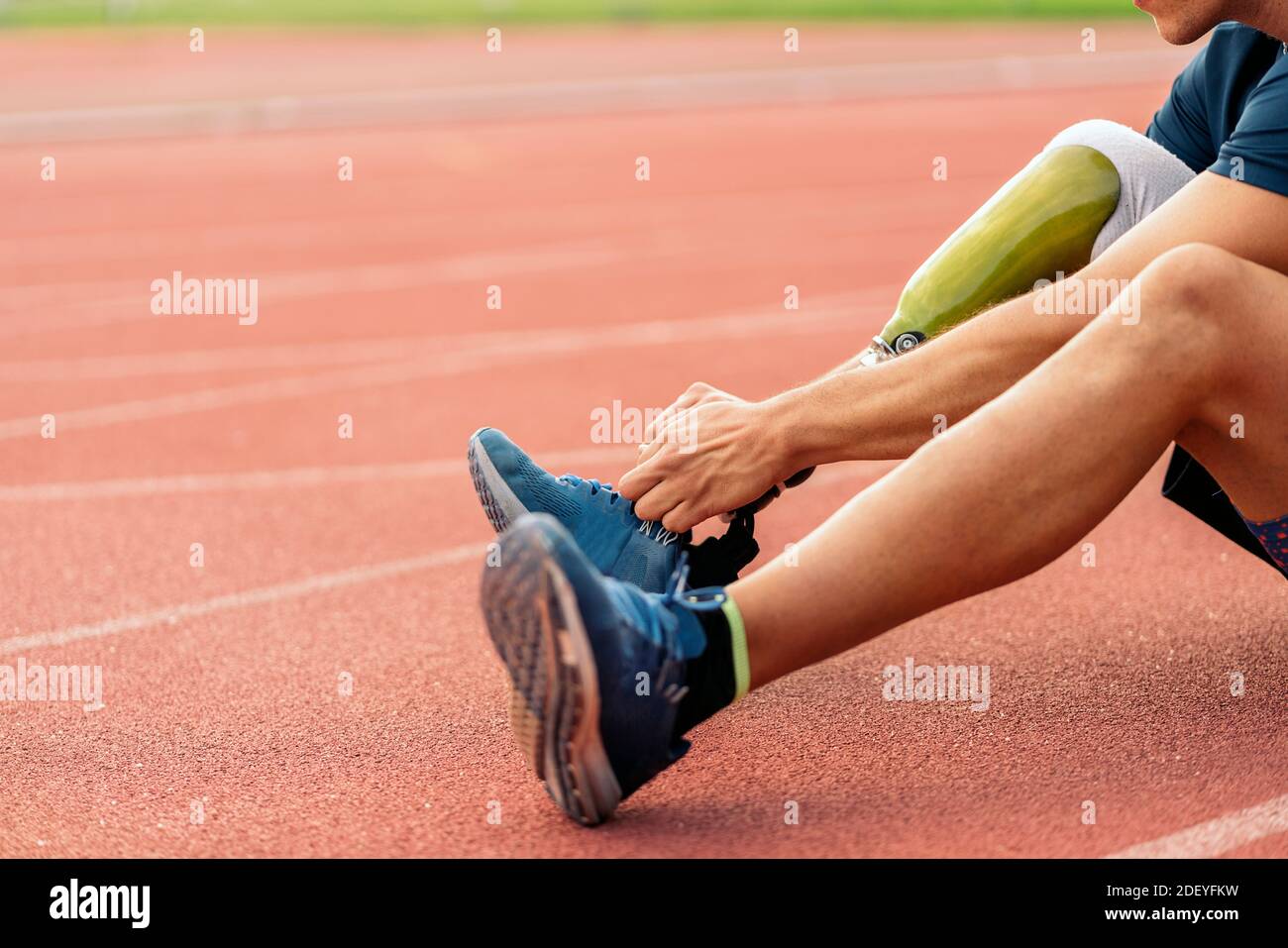 Close up disabled man athlete with leg prosthesis. Paralympic Sport ...