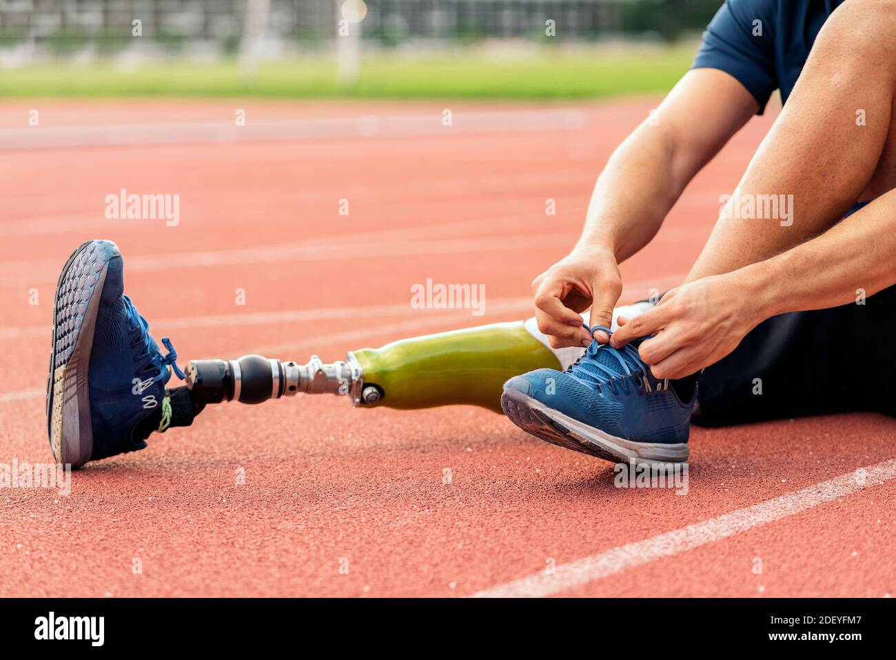Close up disabled man athlete with leg prosthesis. Paralympic Sport ...