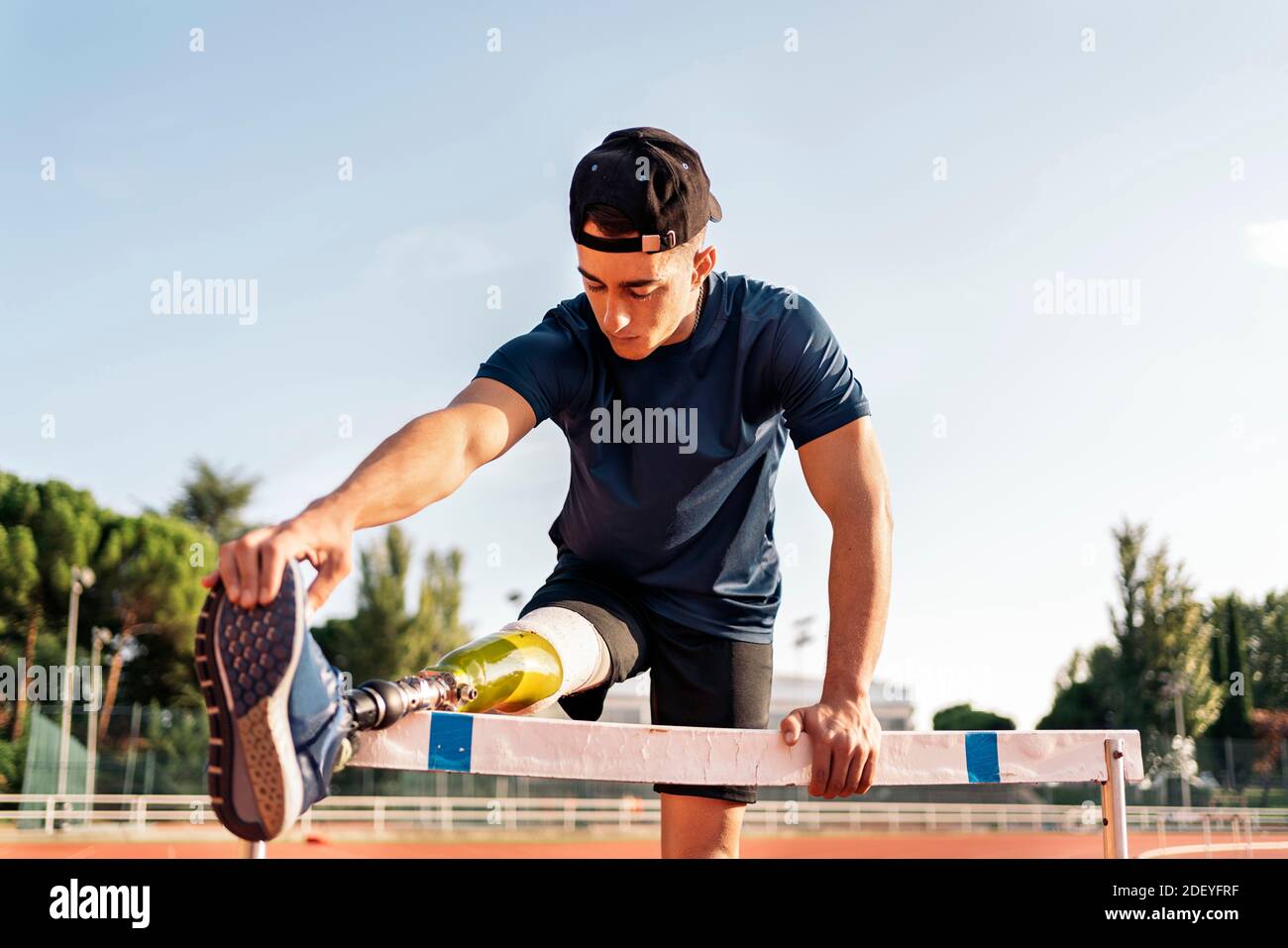 Disabled man athlete stretching with leg prosthesis. Paralympic Sport ...