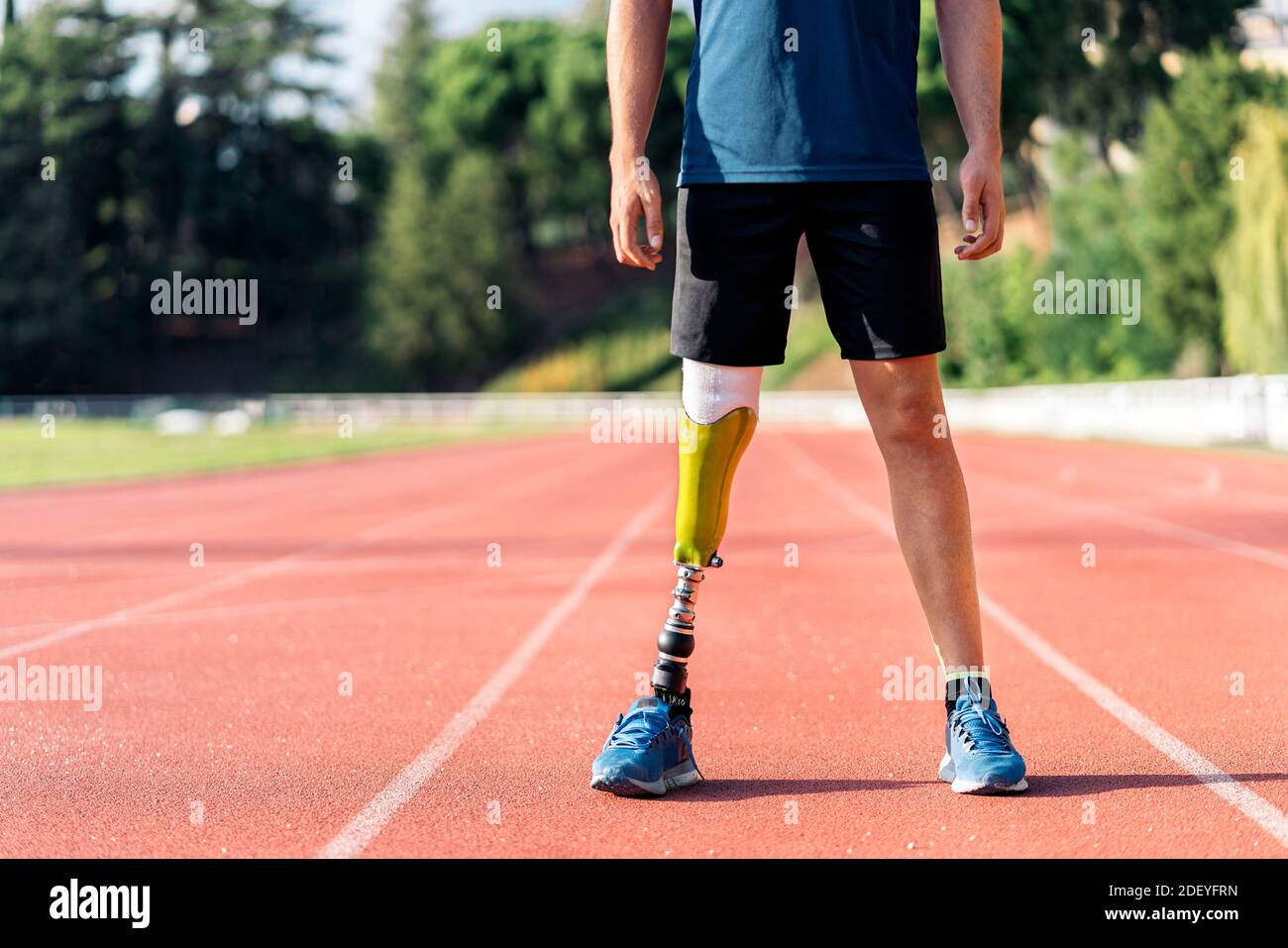 Close up disabled man athlete with leg prosthesis. Paralympic Sport ...