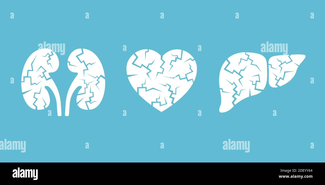 Failure and desease of kidneys, heart and liver. Human organ is ...
