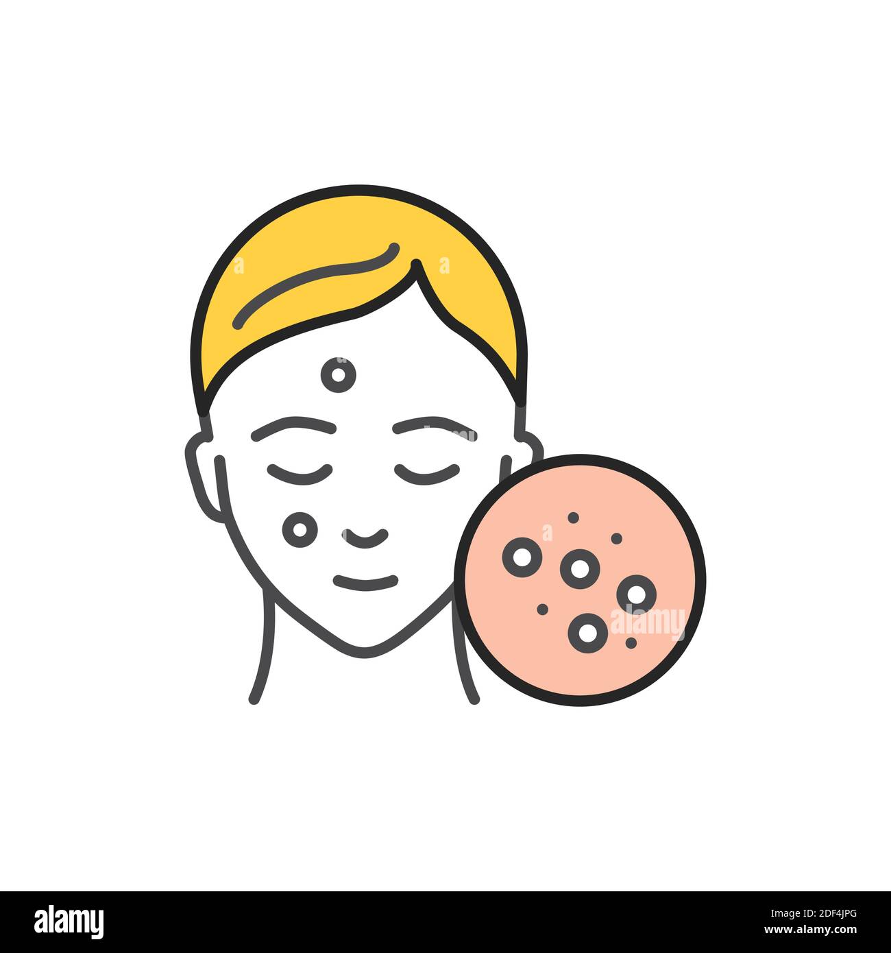 Pustule hi-res stock photography and images - Alamy