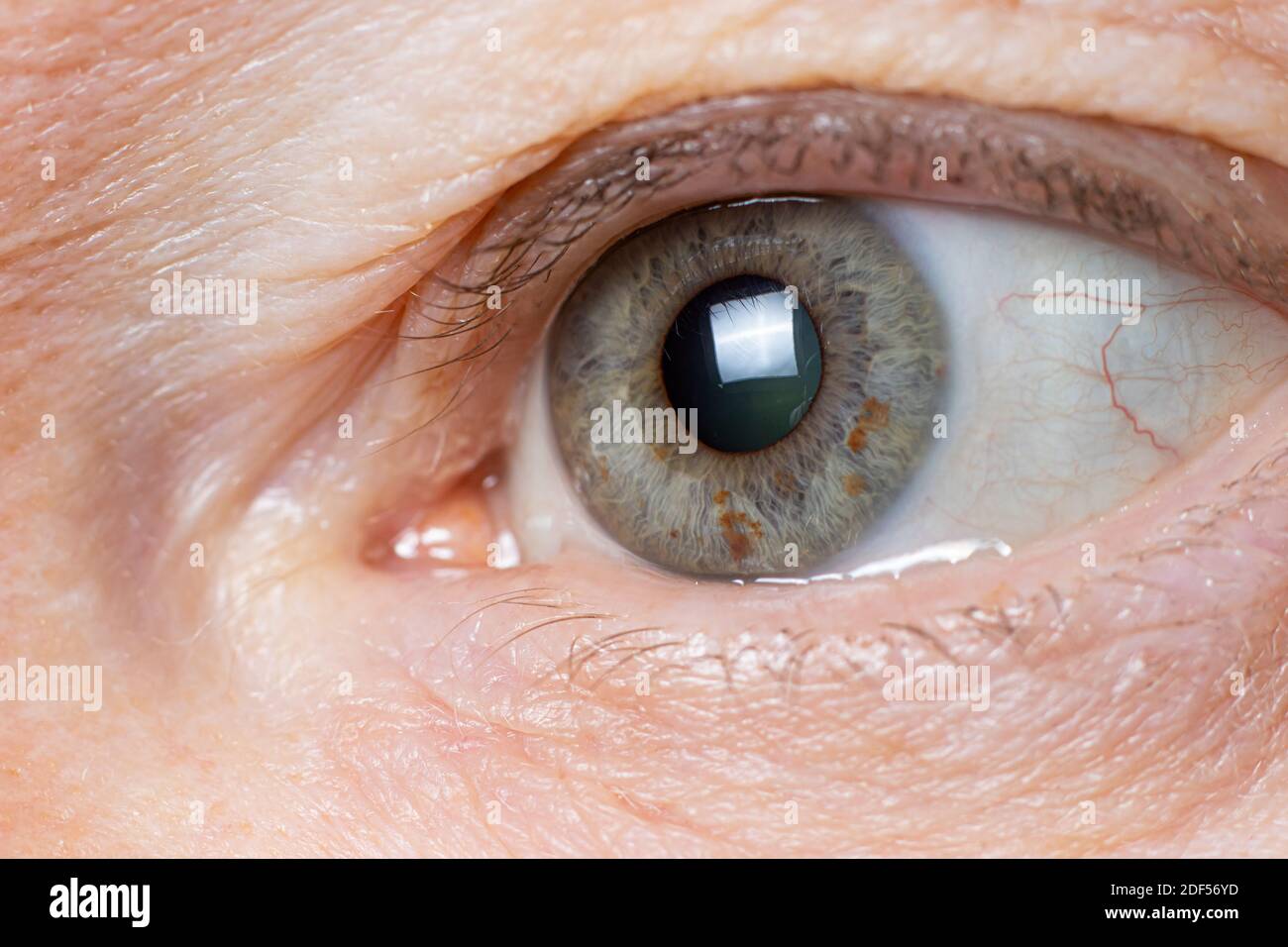 The eye of an old man, an aging eye and a body, old age. Cosmetics for ...