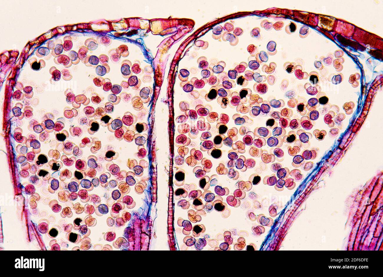 Male Pine Cone Or Strobilus Showing The Pollen Optical Microscope Magnification X100 Stock