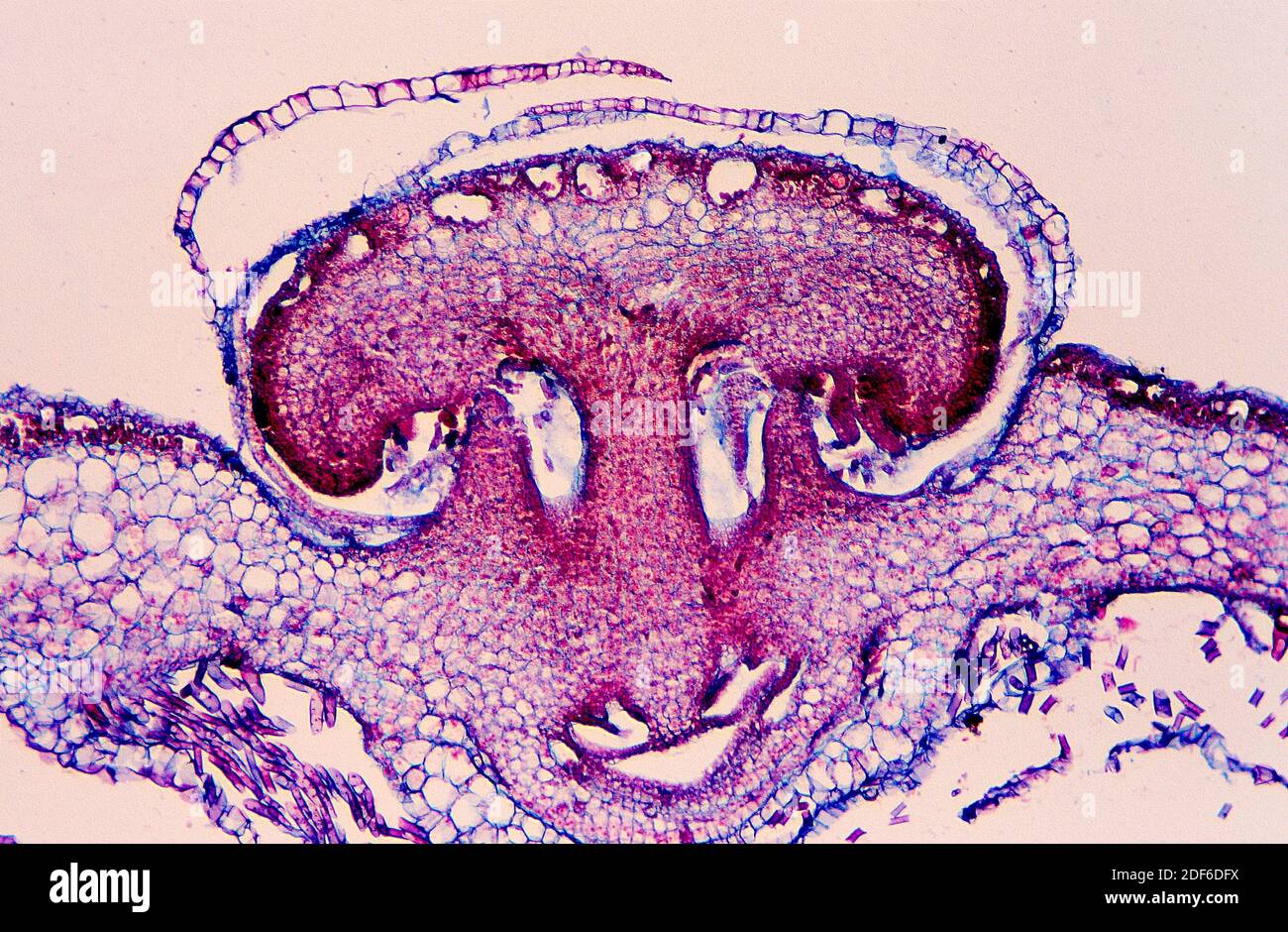 Marchantia Antheridia And Archegonia