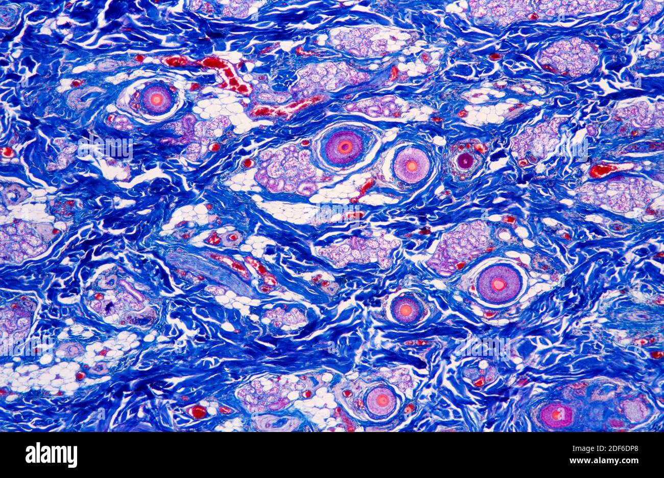 Skin cross section microscope hi-res stock photography and images - Alamy