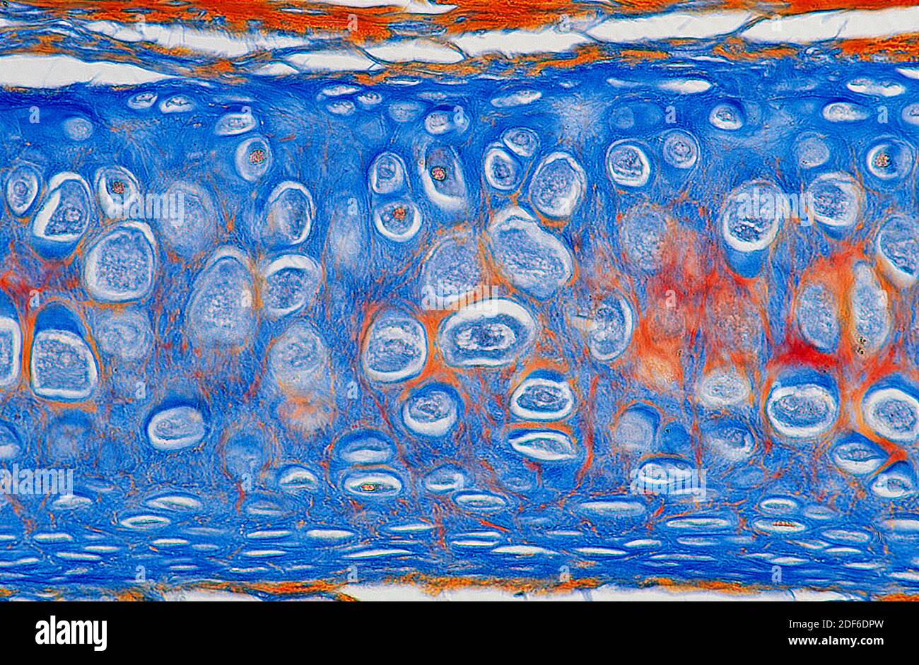 Cartilage Matrix High Resolution Stock Photography and Images - Alamy