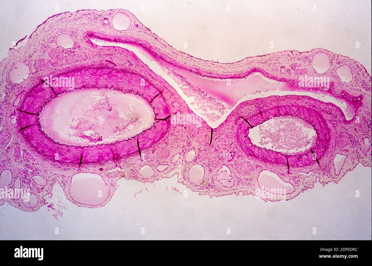 Venules hi-res stock photography and images - Alamy