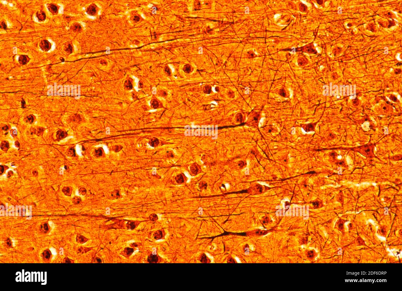 Staining tissue hi-res stock photography and images - Alamy