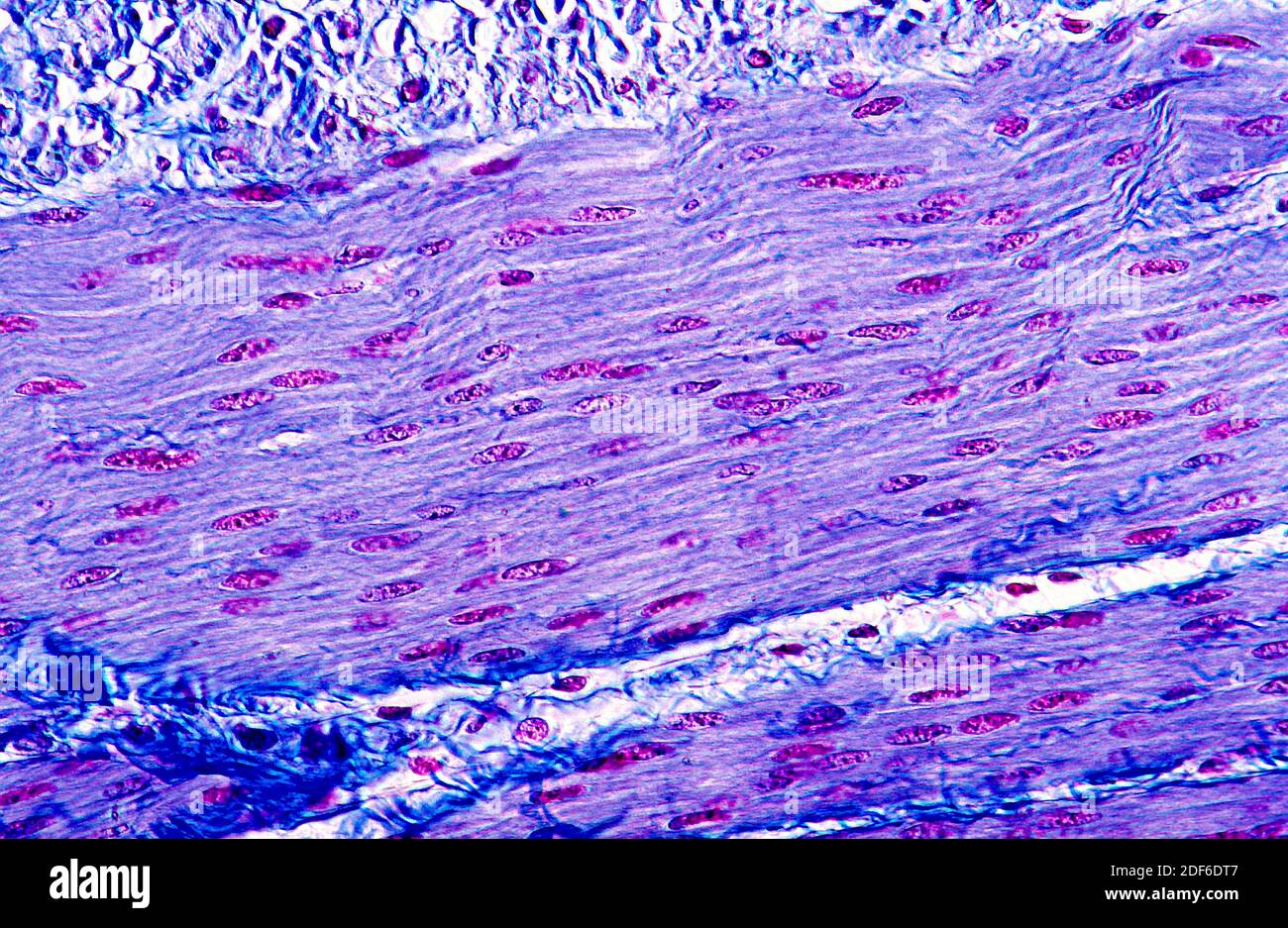 Smooth Muscle Fiber Microscope