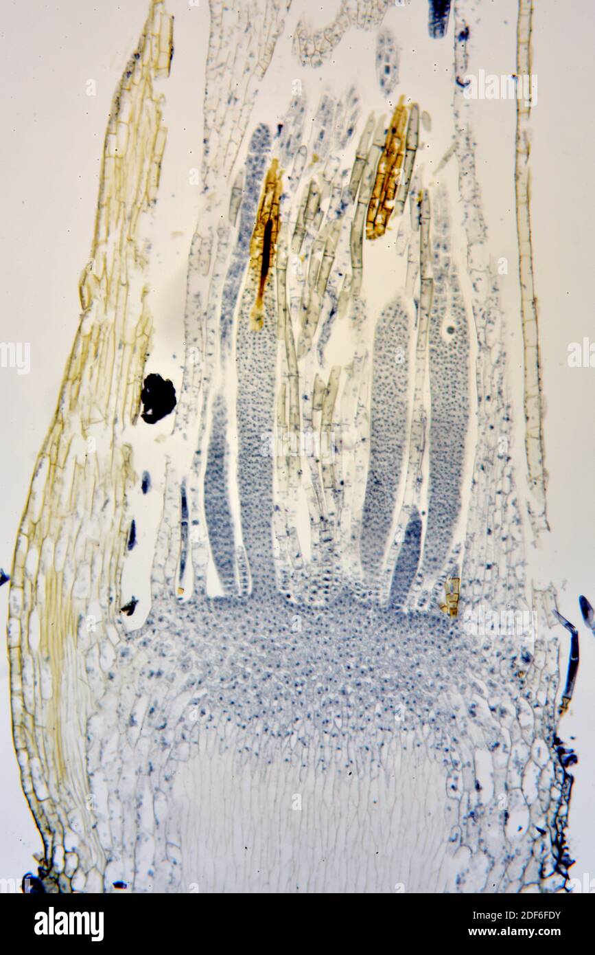 Female reproductive organ hi-res stock photography and images - Alamy