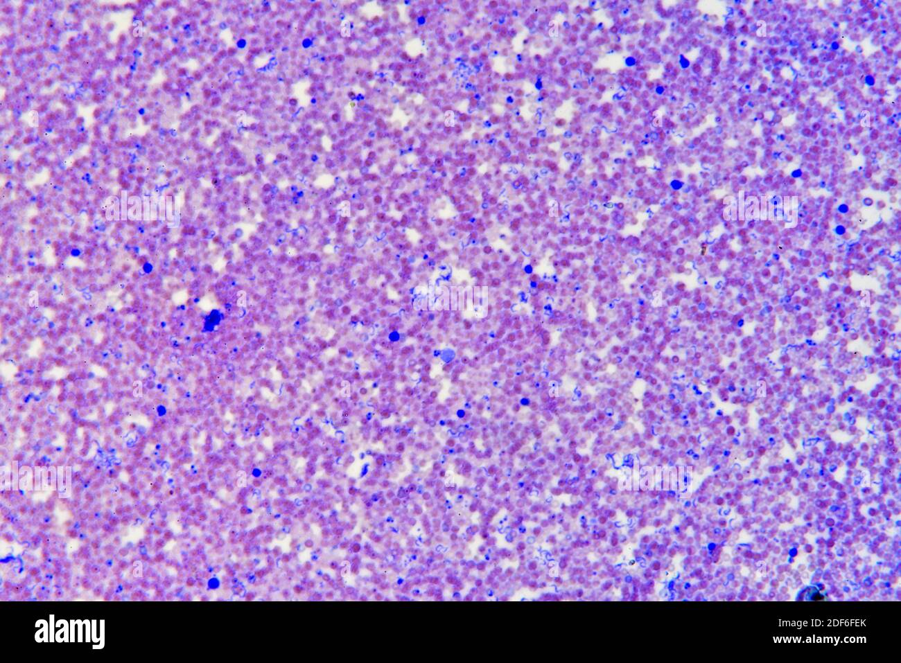 Trypanosoma Under Microscope