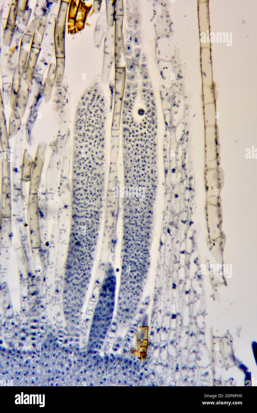 Female reproductive organ hi-res stock photography and images - Alamy