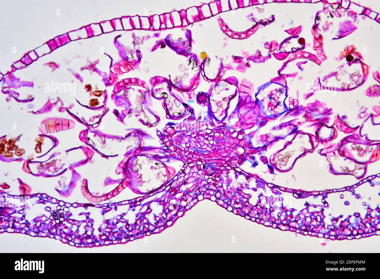 Fern Sori Microscope
