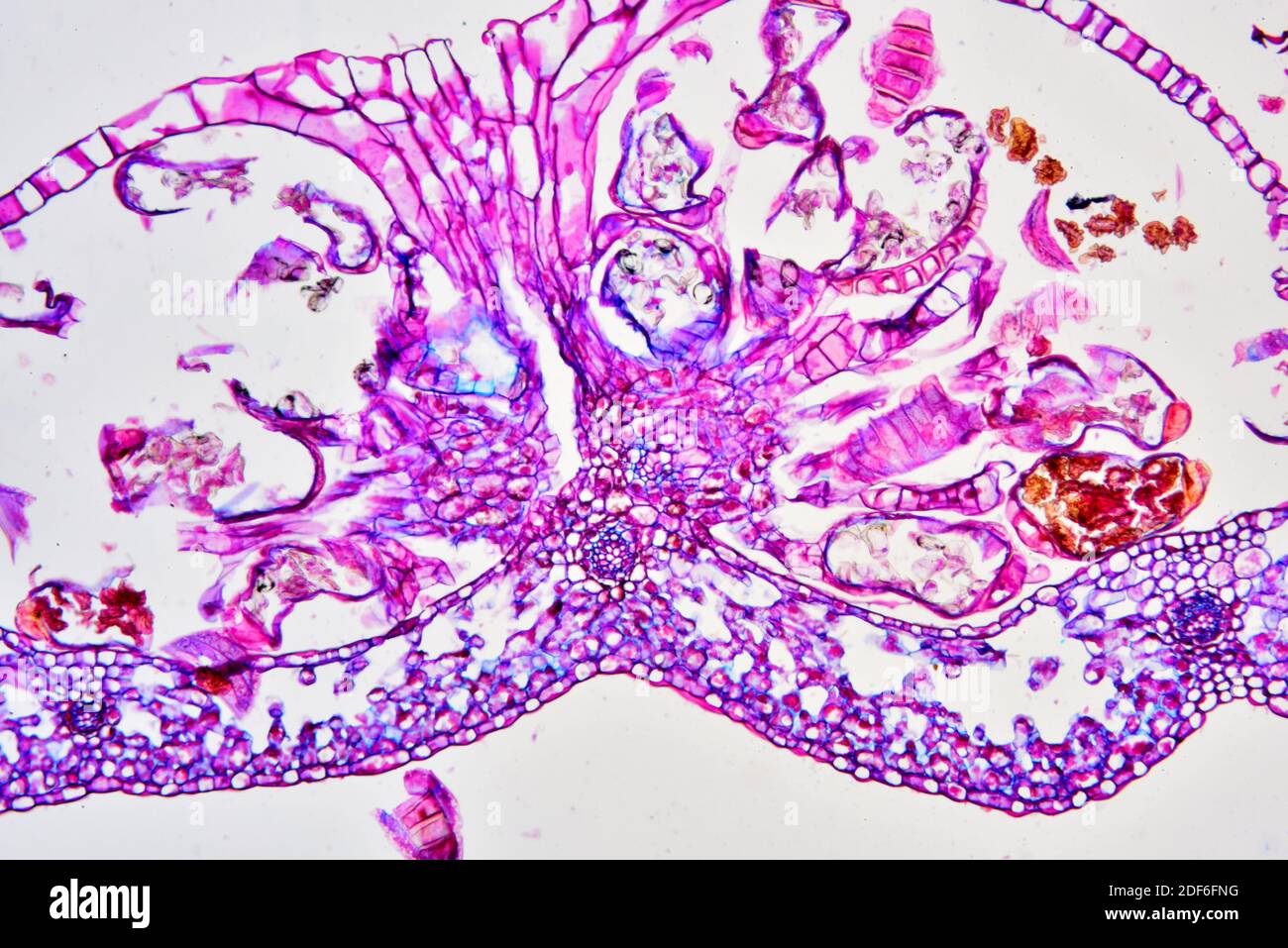 Sorus hi-res stock photography and images - Alamy