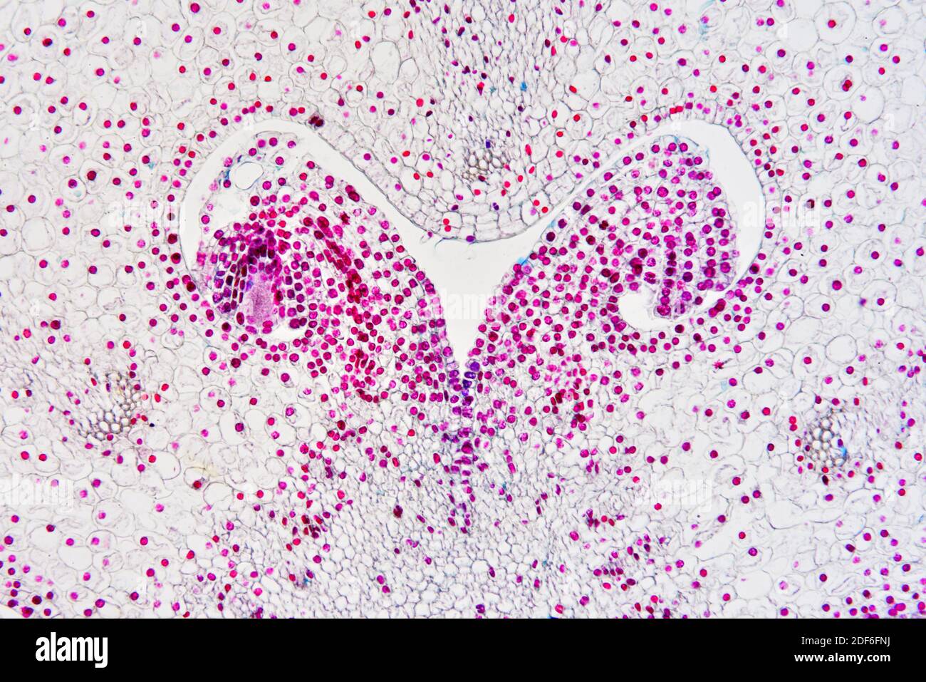 Ovary micrograph hi-res stock photography and images - Alamy Ovary micrograph hi-res stock photography and images - Alamy