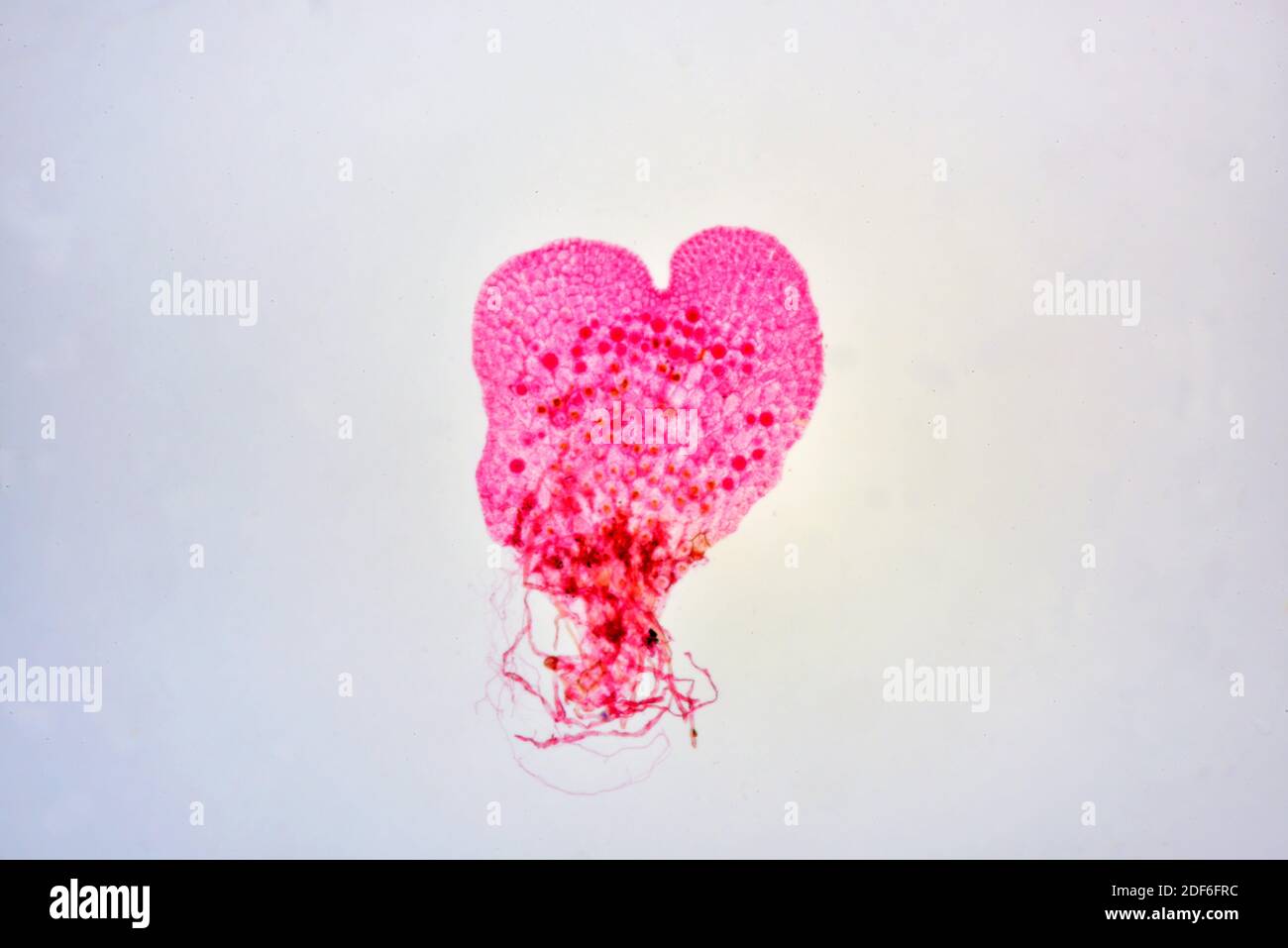 Fern prothallus or prothallium with rhizoids. Optical microscope X40 ...