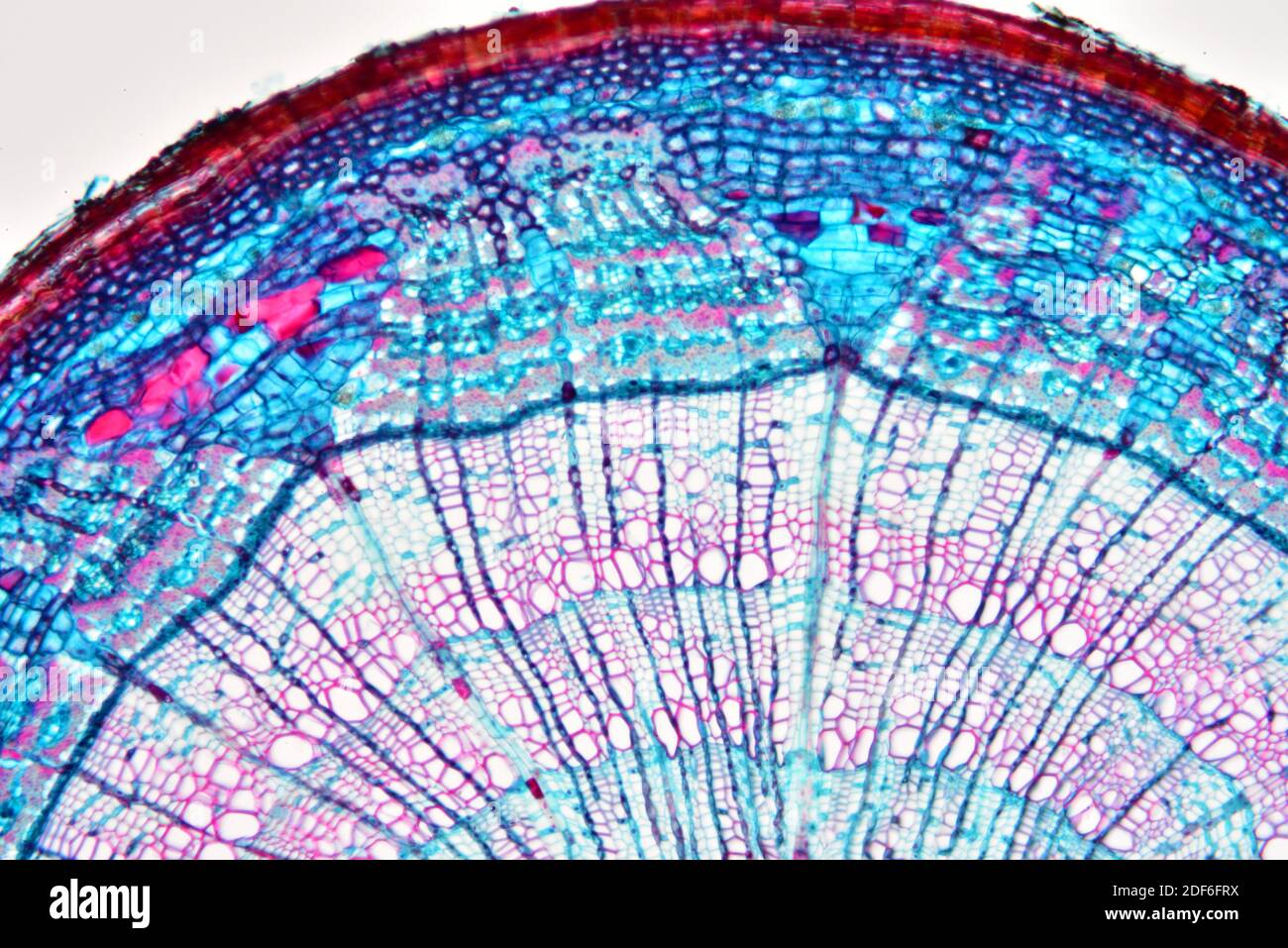 Phloem micrograph hi-res stock photography and images - Alamy