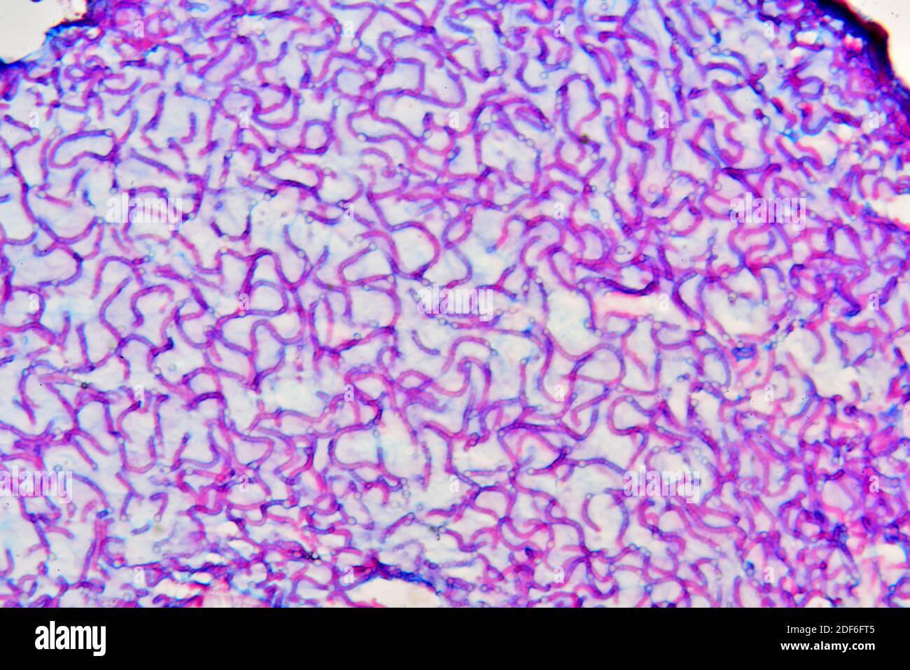 Cyanobacteria Micrograph High Resolution Stock Photography and Images ...