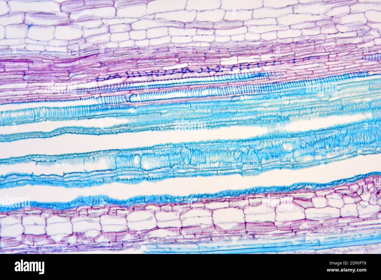 Conducting tissue hi-res stock photography and images - Alamy