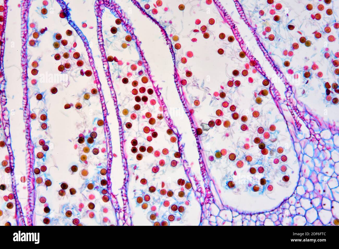 Horsetail Strobilus Microscope