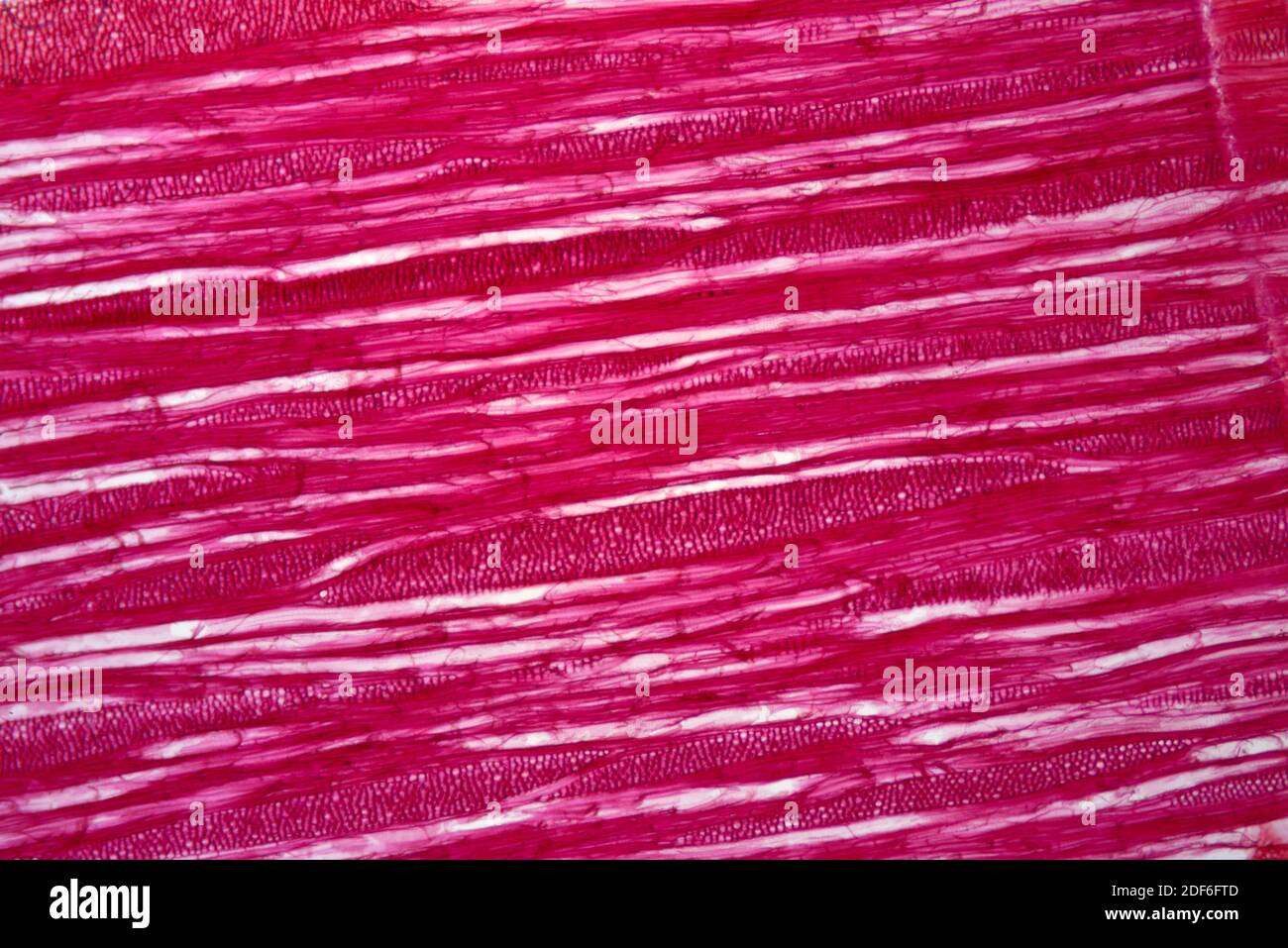 Xylem micrograph hi-res stock photography and images - Alamy