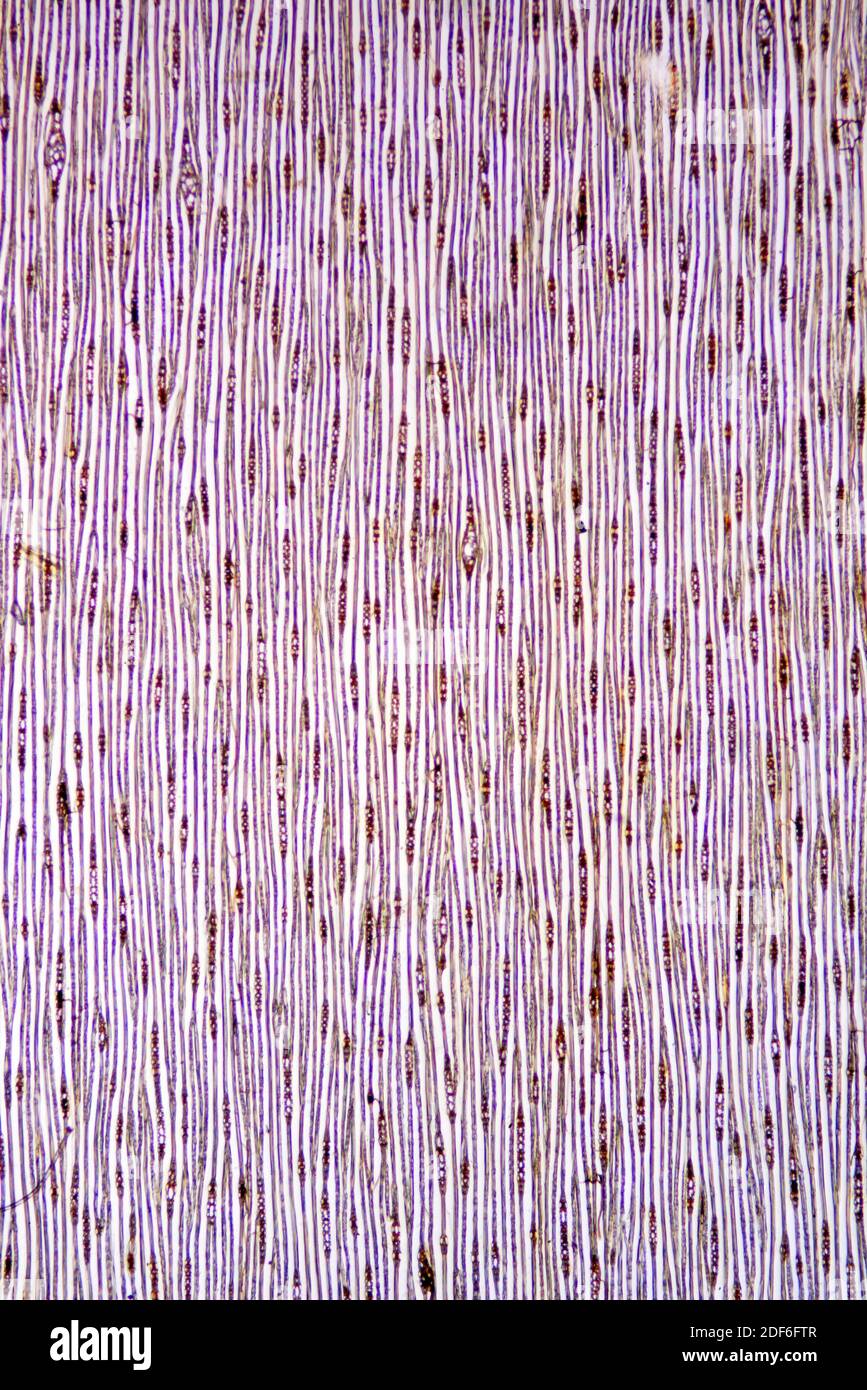 Longitudinal radial section hi-res stock photography and images - Alamy