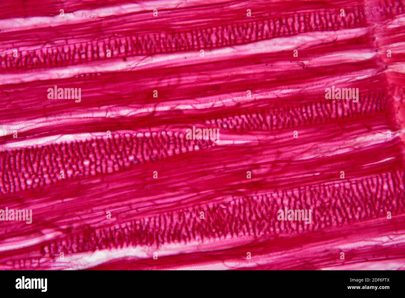Xylem Micrograph High Resolution Stock Photography and Images - Alamy