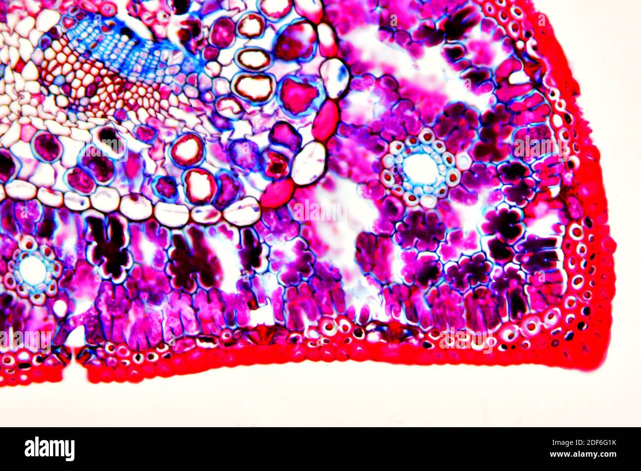 Hypodermis hi-res stock photography and images - Alamy