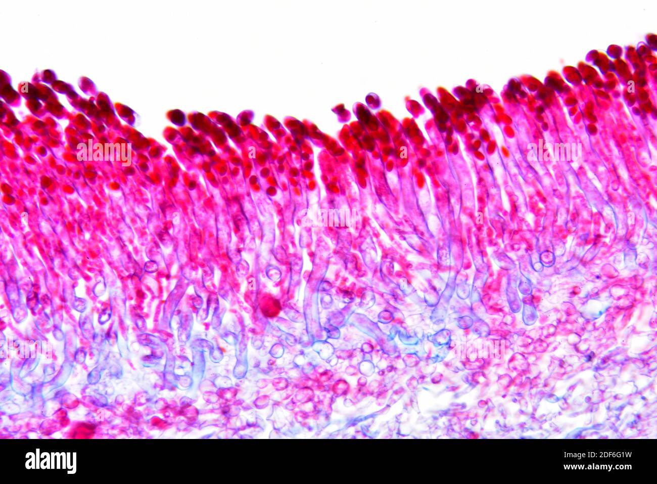 Phylum Ascomycota Microscope