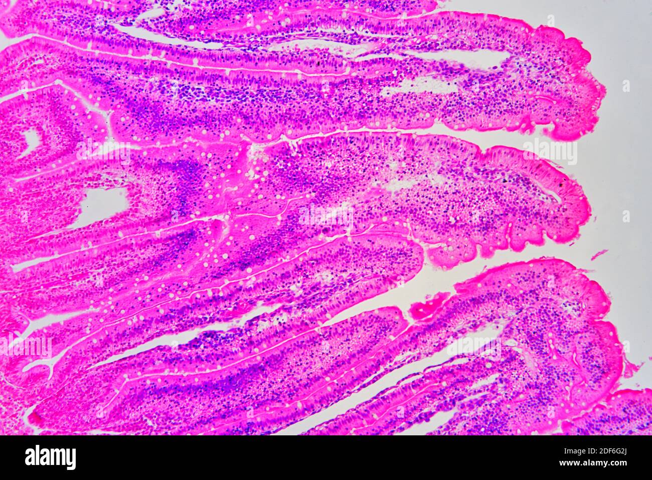 Digestive tract micrograph hi-res stock photography and images - Alamy