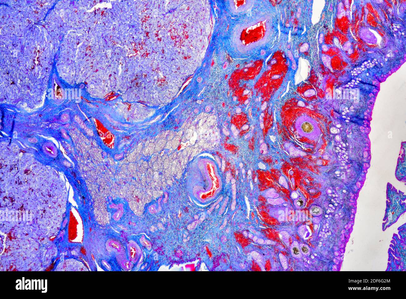 Human Corpus Luteum Slide