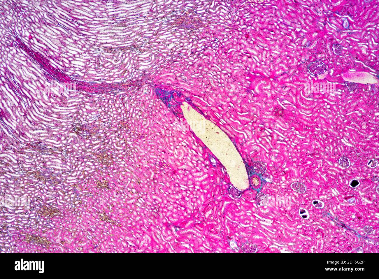 Kidney Nephron Microscope