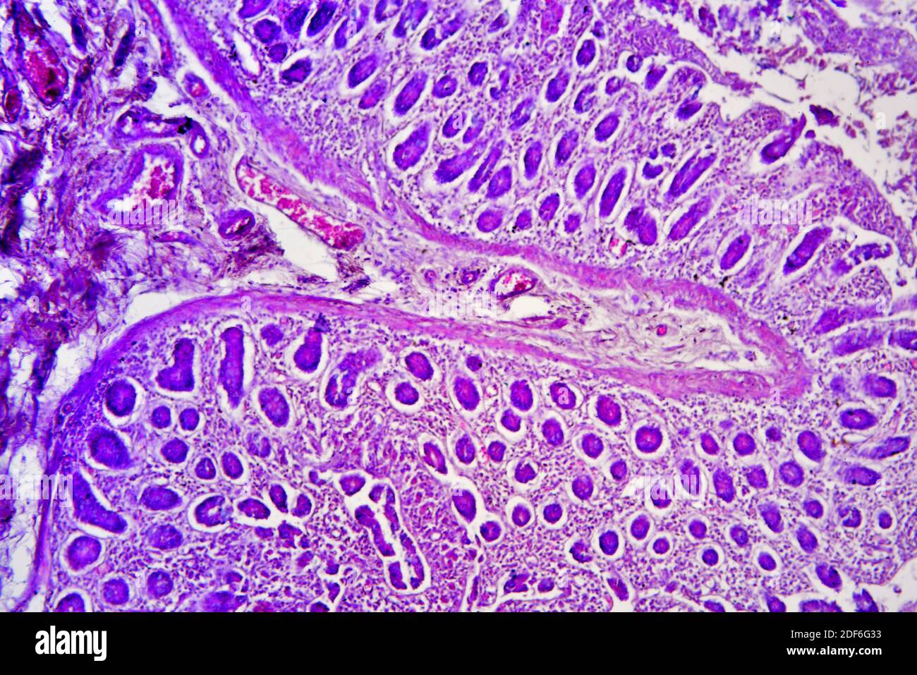 Digestive tract micrograph hi-res stock photography and images - Alamy