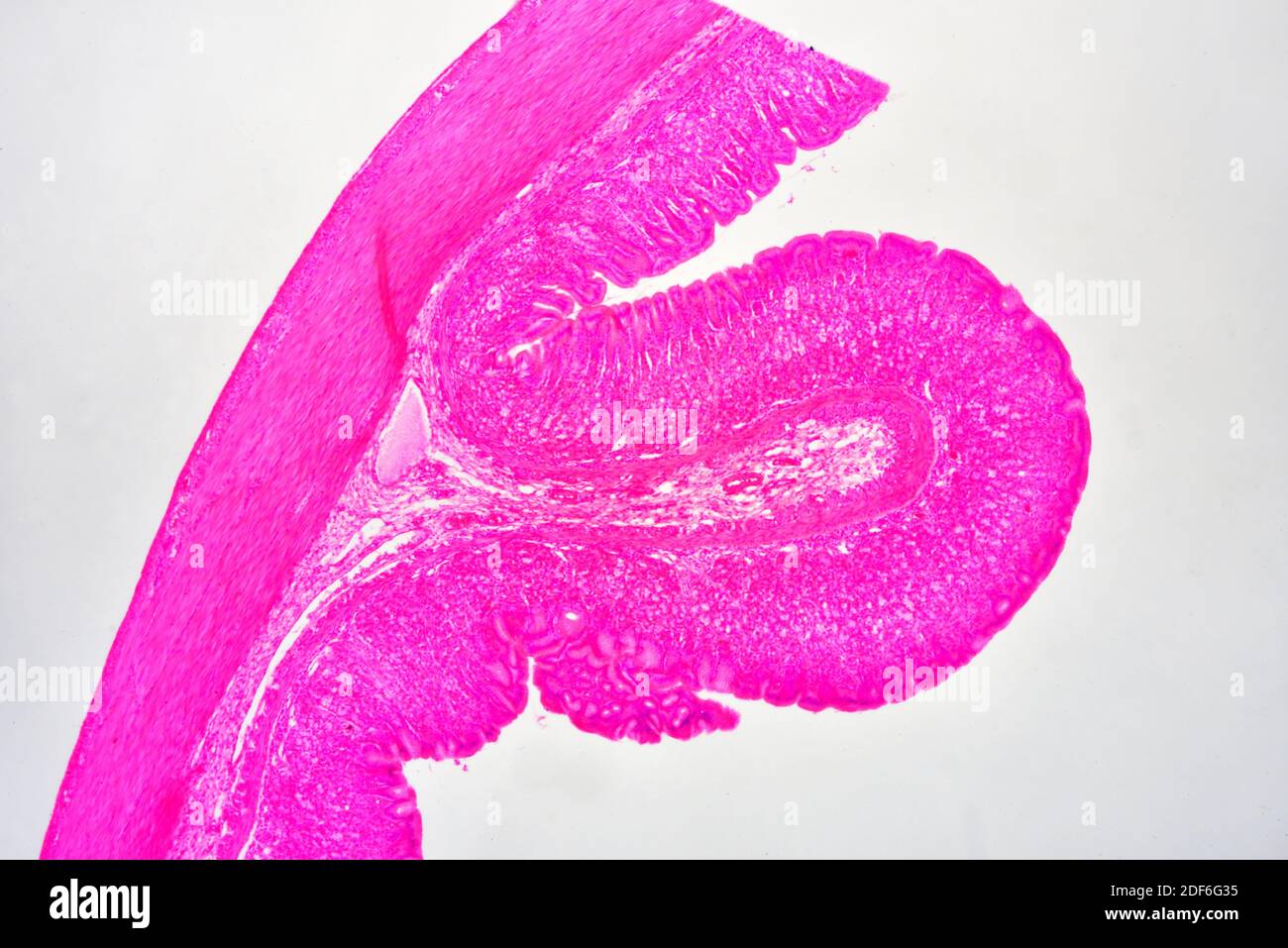 Serosa High Resolution Stock Photography and Images - Alamy